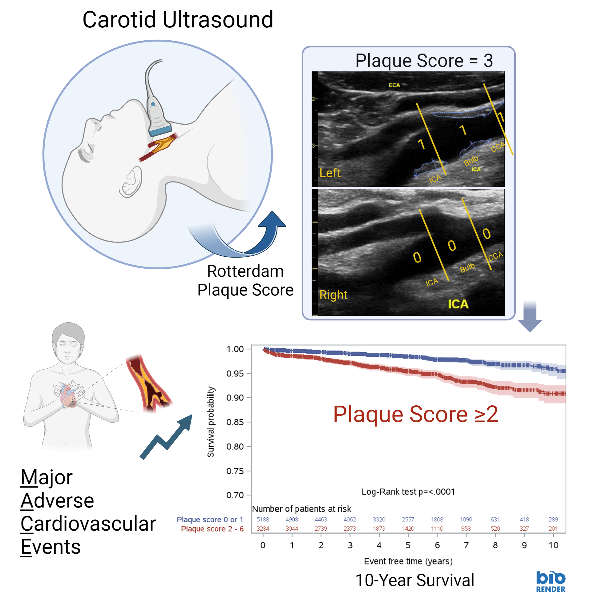 Carotid plaque score is associated with 10-year major adverse ...